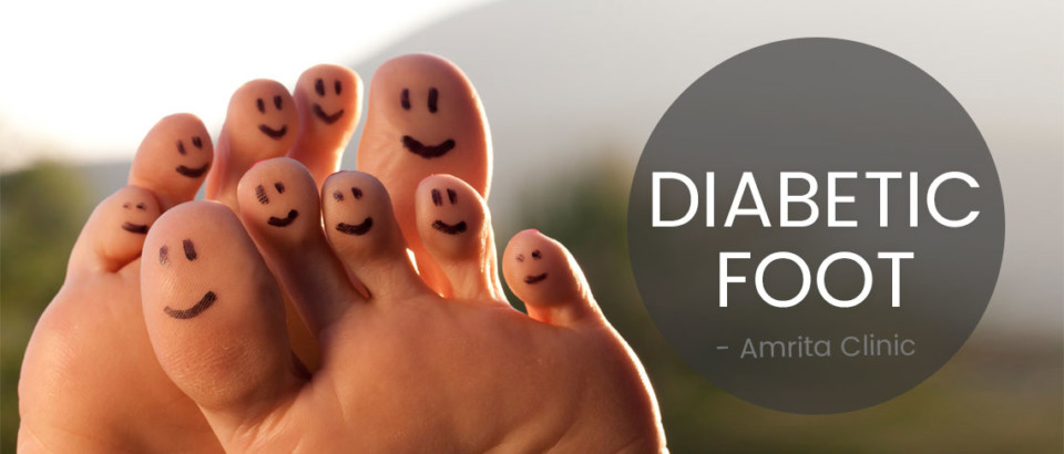 What Is Anal Fistula? - Amrita Clinic